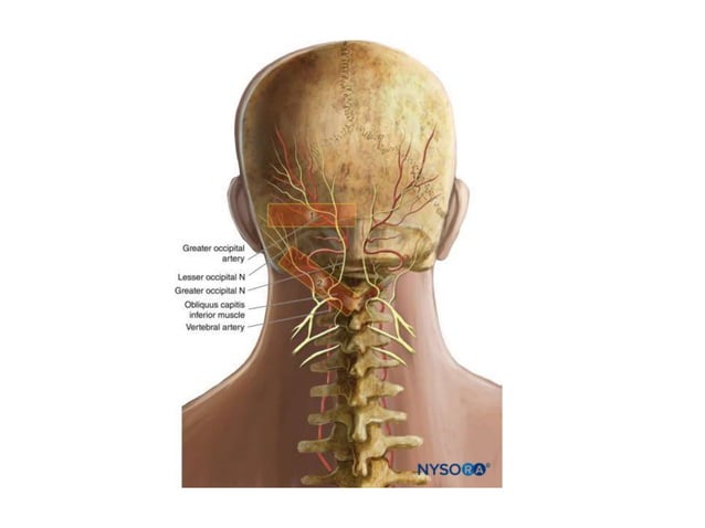 SCALP Block scalp block scalp block scalp | PPTX