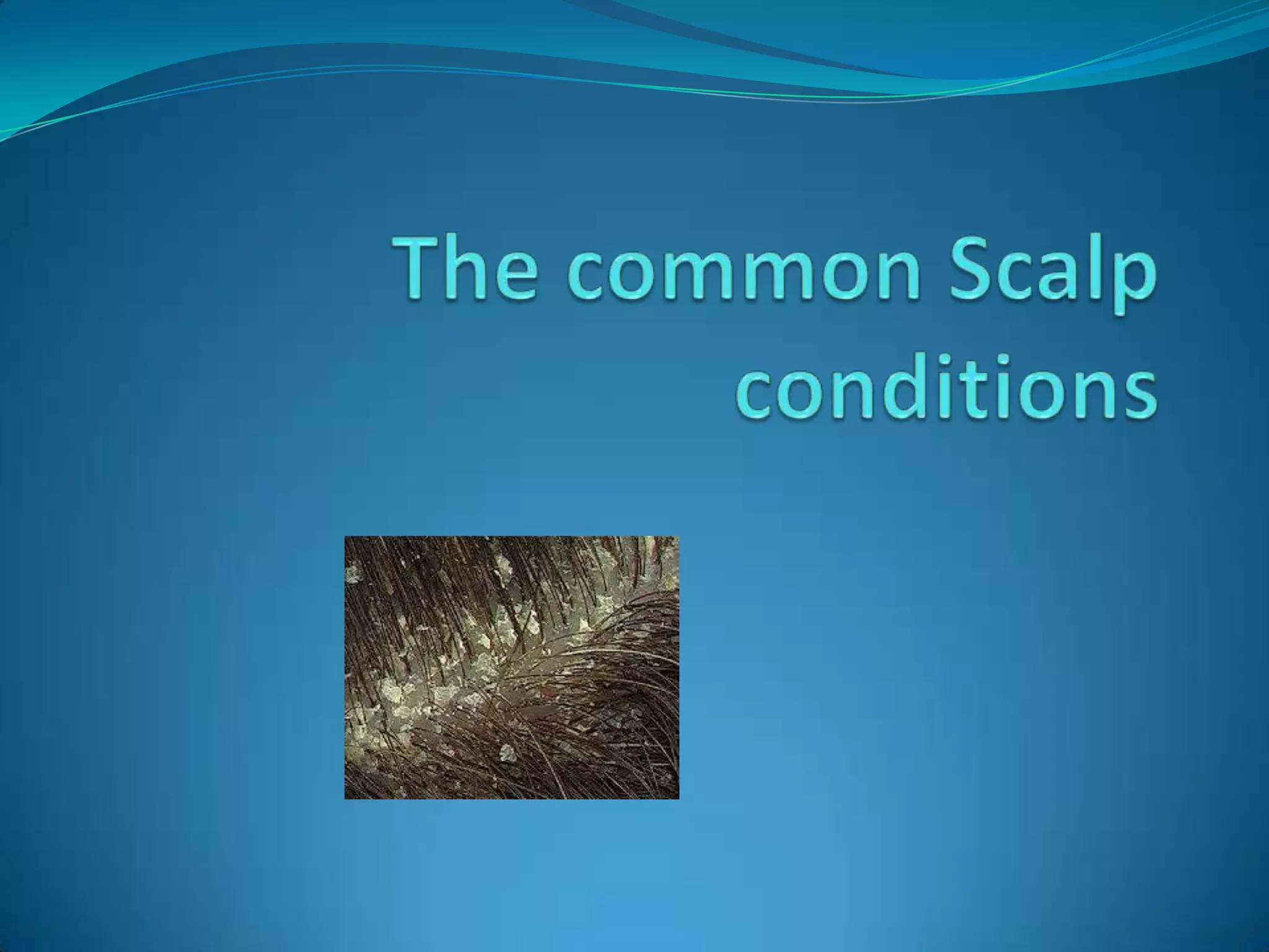 Scalp conditions | PPT