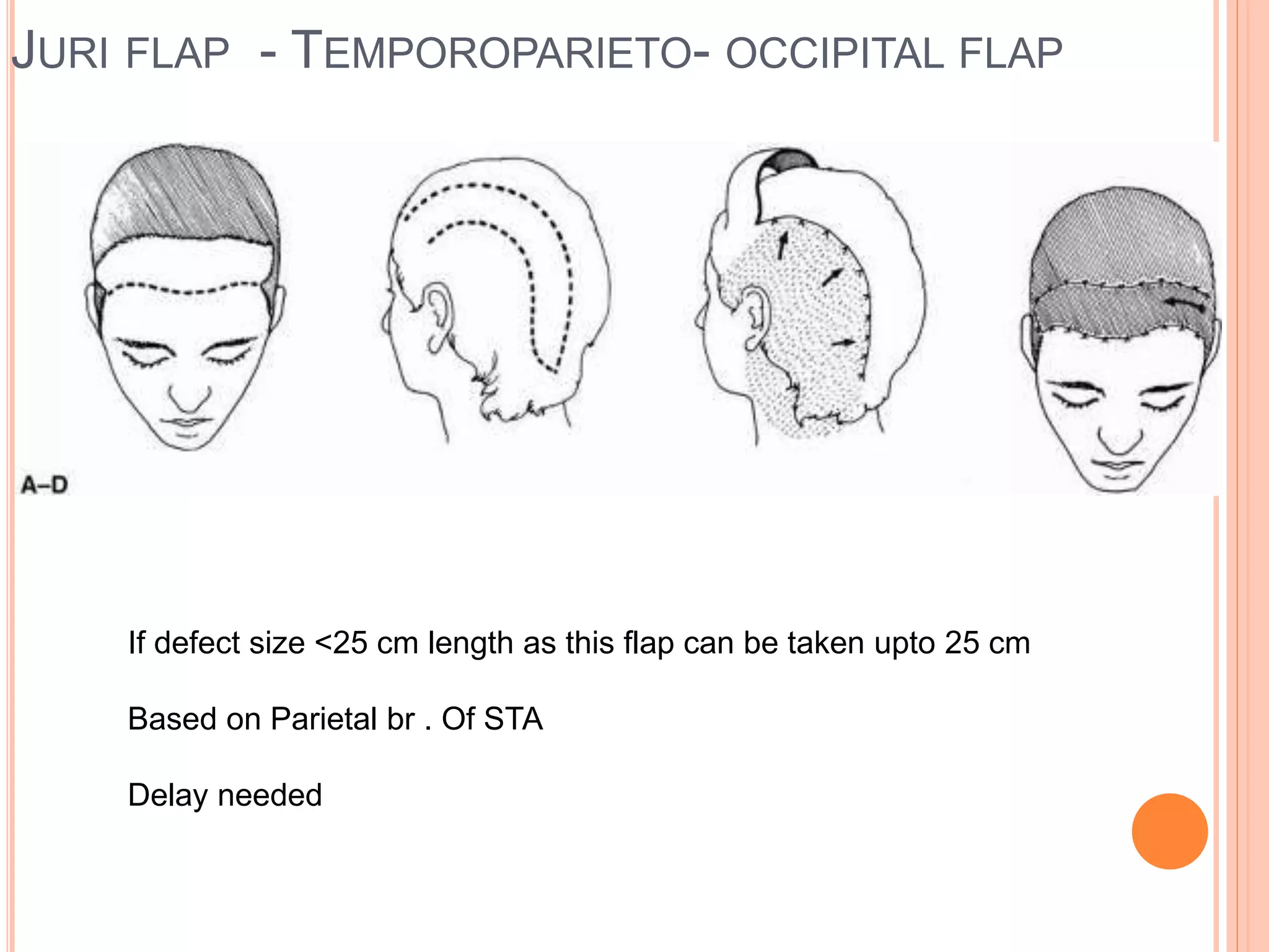 Scalp defects | PPTX