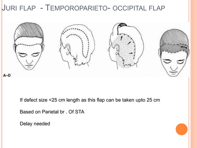 Scalp defects | PPTX