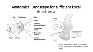 Scalpelless Vasectomy by Dr Dirk Grothuesmann | PPT