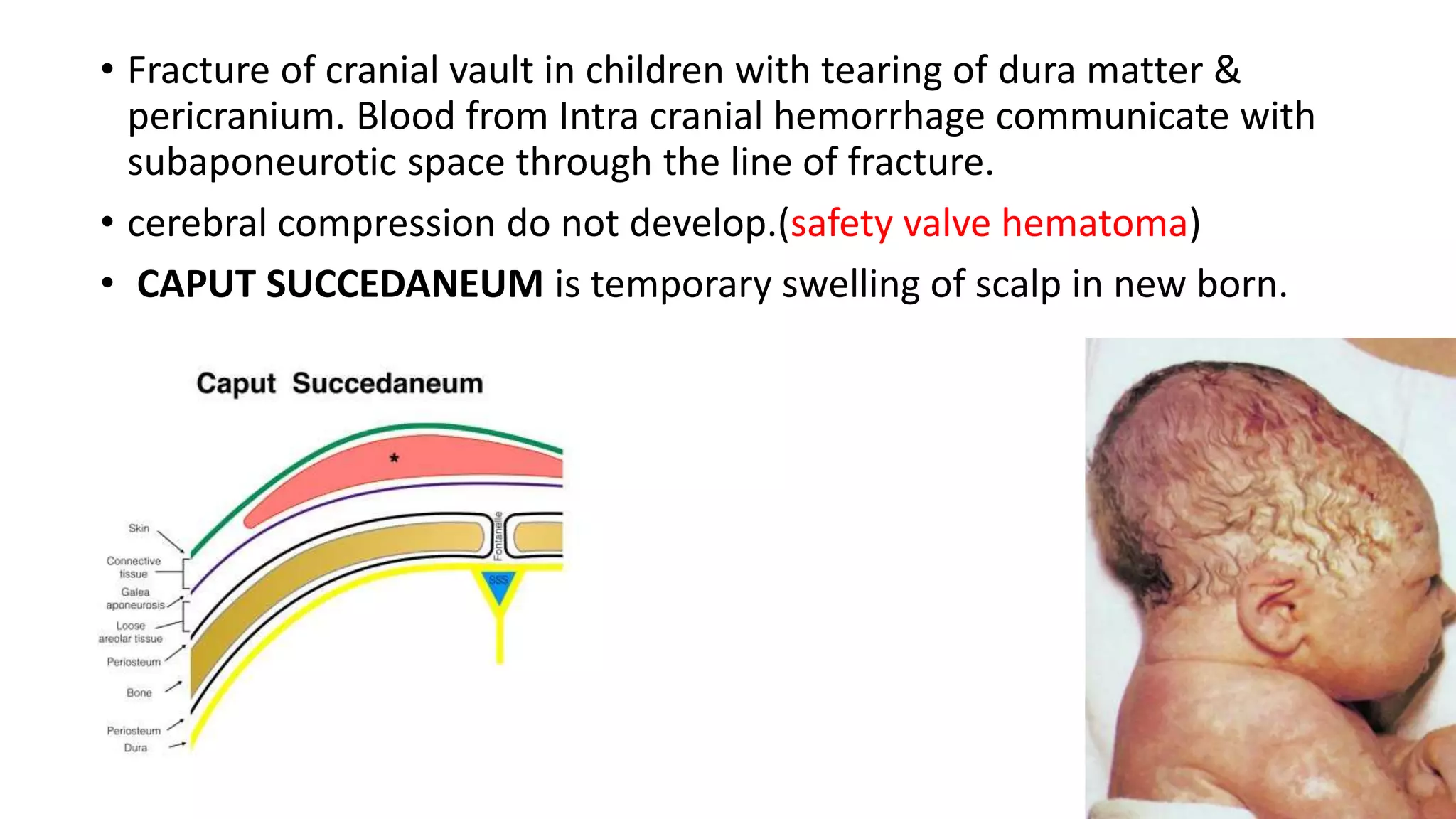 Scalp forensic antomy | PPTX