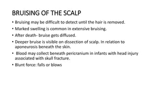 Scalp forensic antomy | PPTX