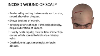 Scalp forensic antomy | PPT