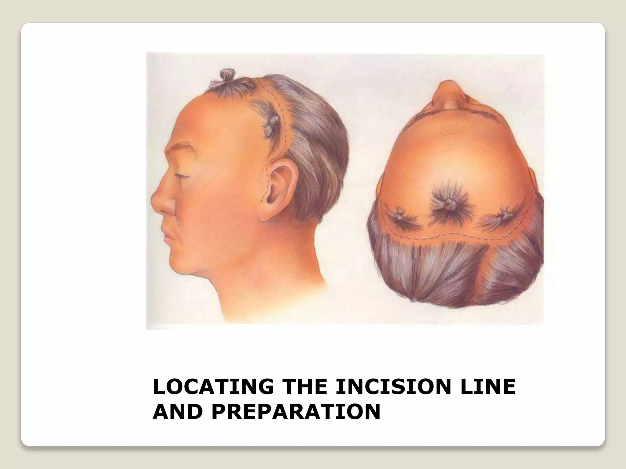 Anatomy of scalp | PPTX