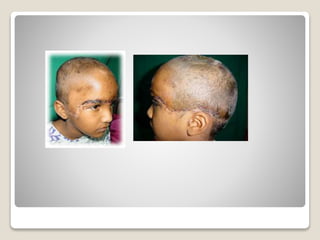 Anatomy of scalp | PPTX