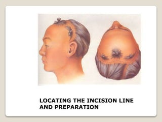 Anatomy of scalp | PPT