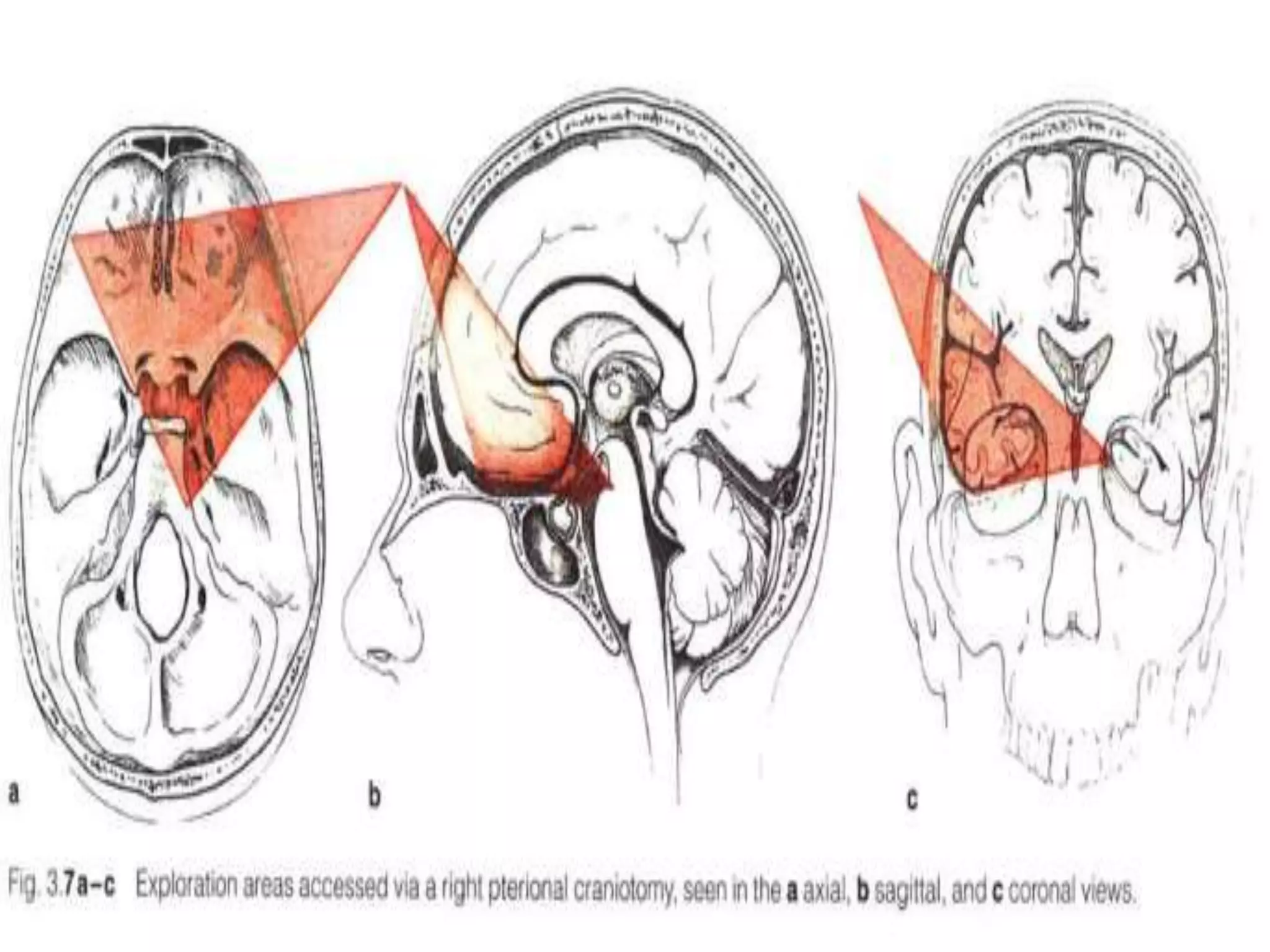 Scalp incision and blood supply | PPTX