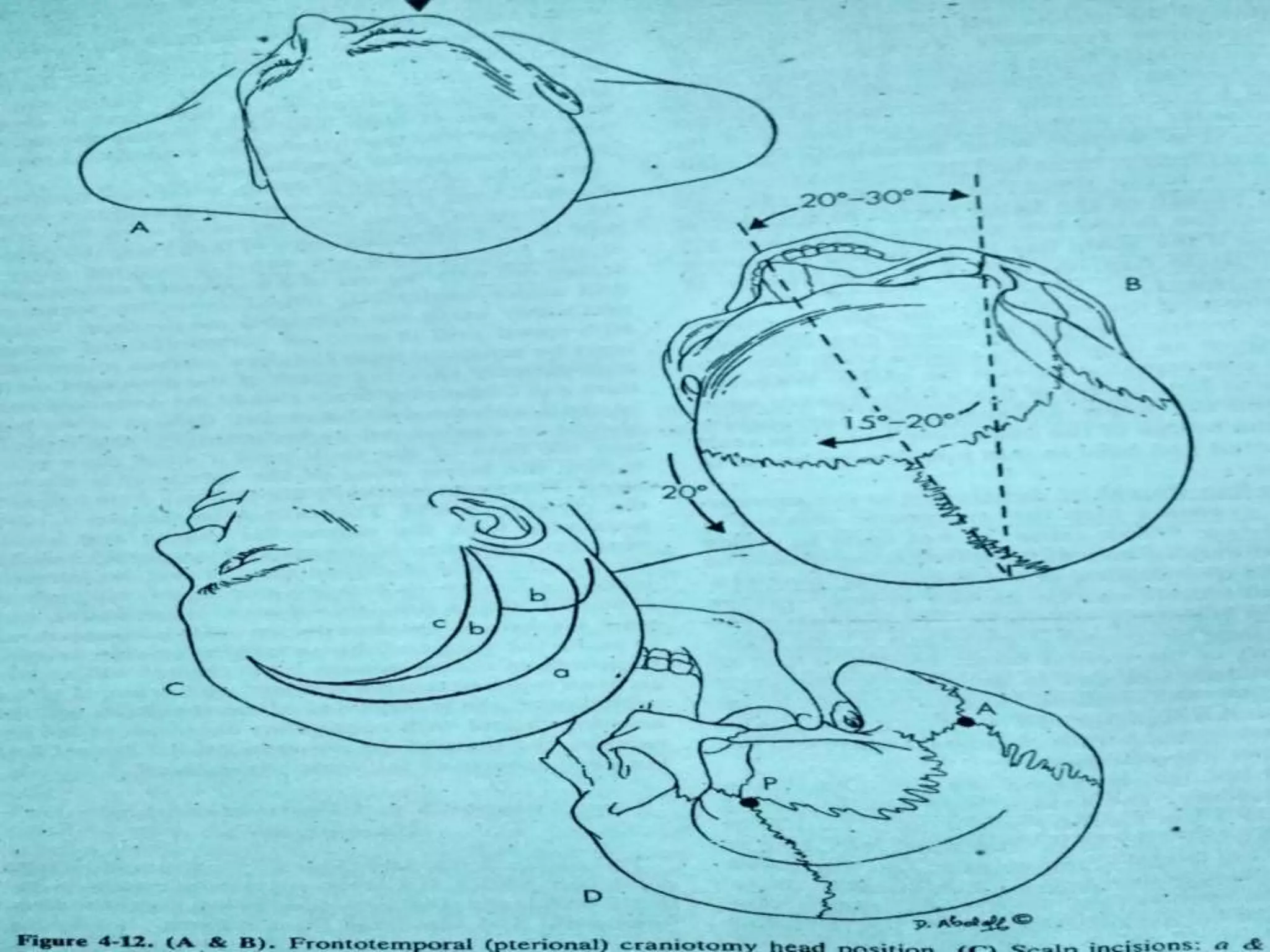 Scalp incision and blood supply | PPTX