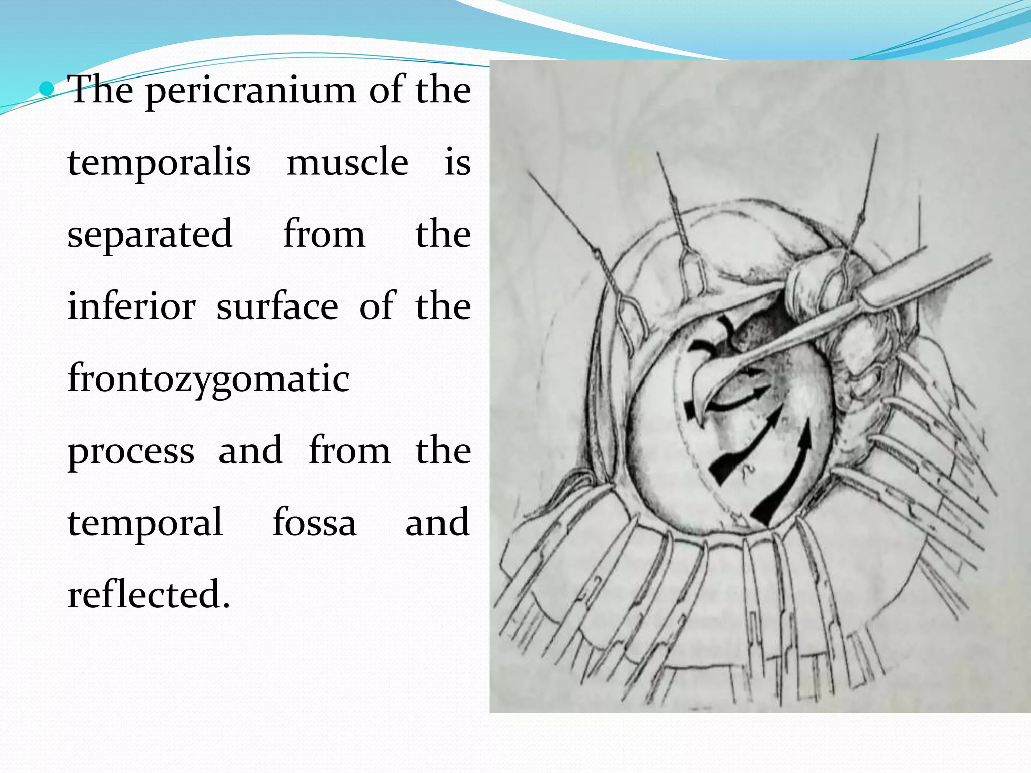 Scalp incision and blood supply | PPTX