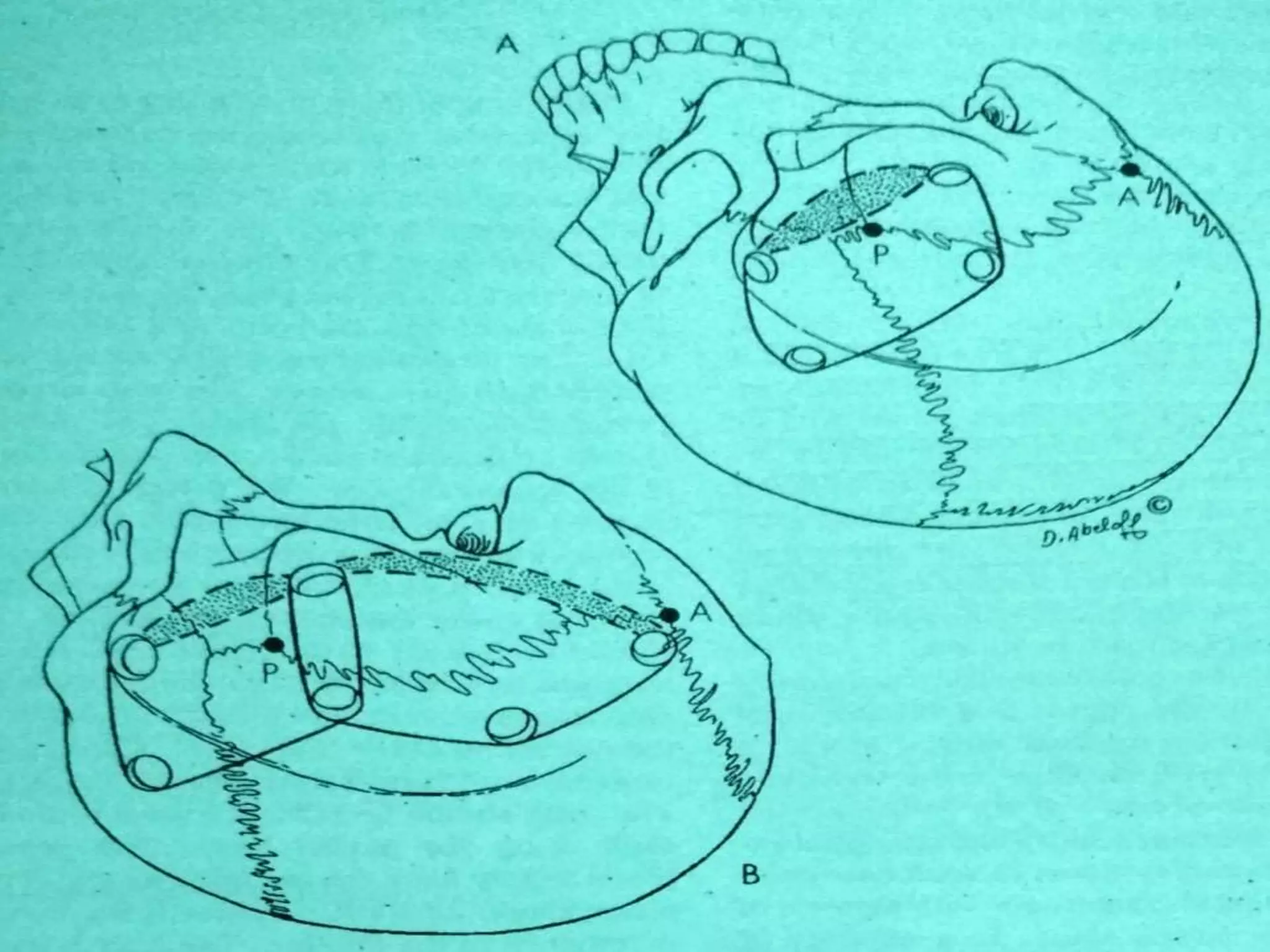 Scalp incision and blood supply | PPTX