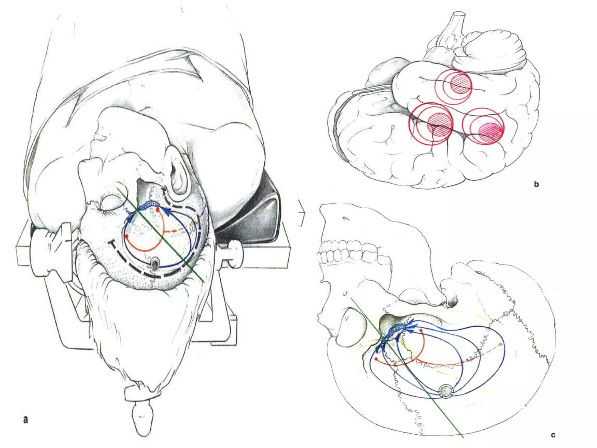 Scalp incision and blood supply | PPTX