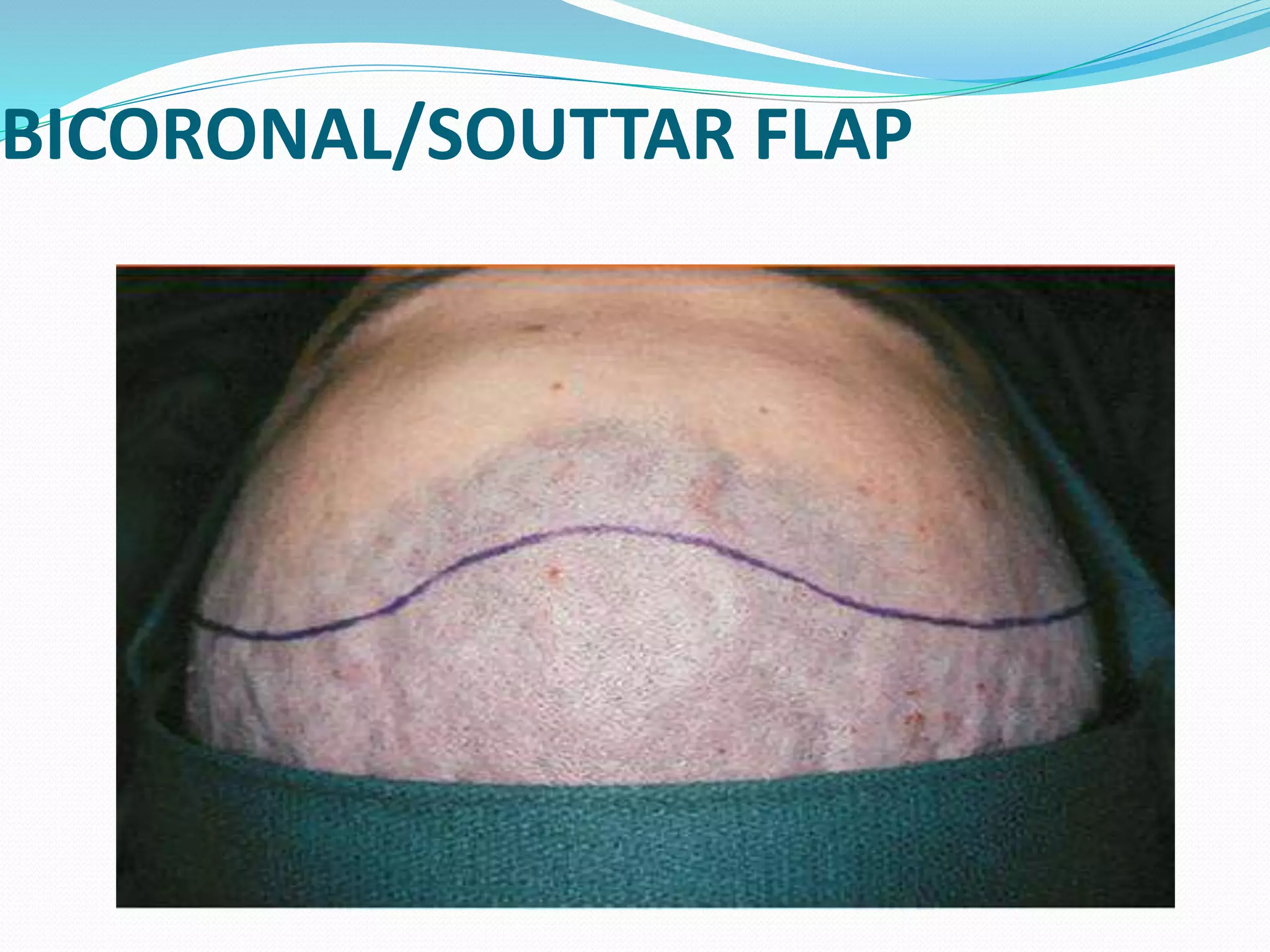 Scalp incision and blood supply | PPTX