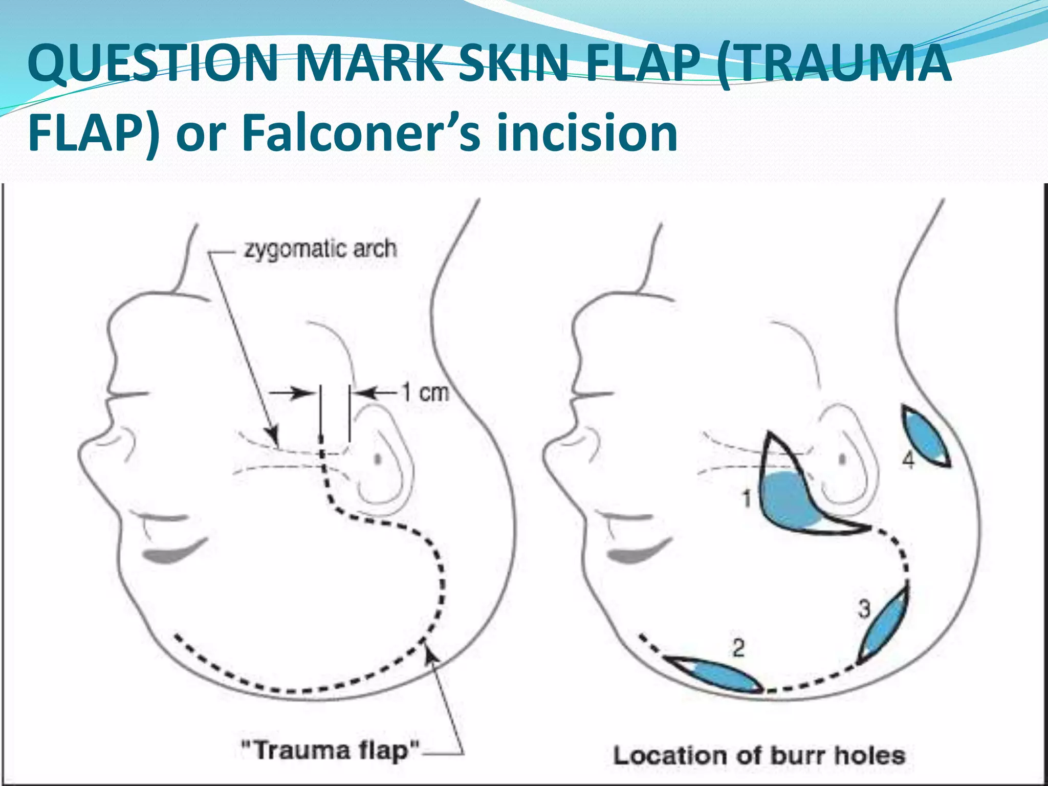 Scalp incision and blood supply | PPTX