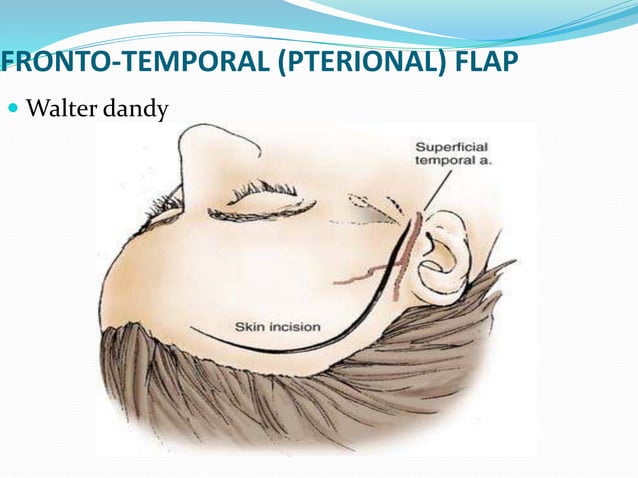 Scalp incision and blood supply | PPTX