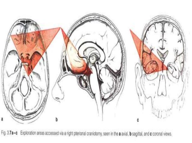 Scalp incision and blood supply | PPTX