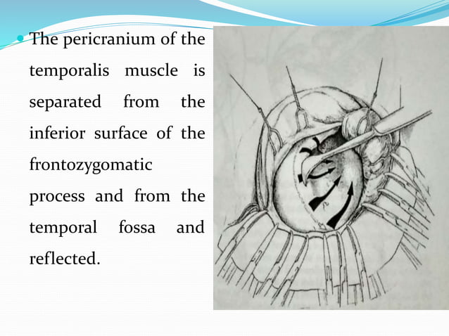Scalp incision and blood supply | PPTX