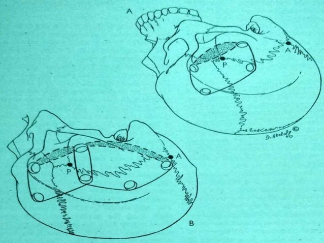 Scalp incision and blood supply | PPTX
