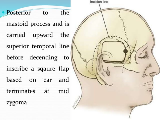 Scalp incision and blood supply | PPTX