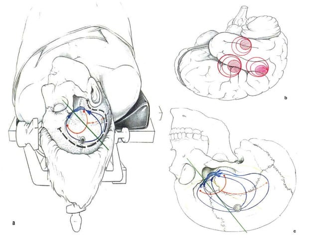 Scalp incision and blood supply | PPTX