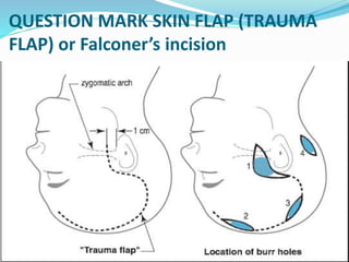 Scalp incision and blood supply | PPTX