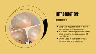 Scalp Micropigmentation (SMP) | Hair Tattoo | PDF