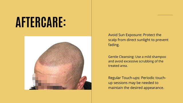 Scalp Micropigmentation (SMP) | Hair Tattoo | PDF