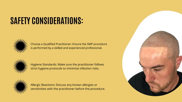 Scalp Micropigmentation (SMP) | Hair Tattoo | PDF