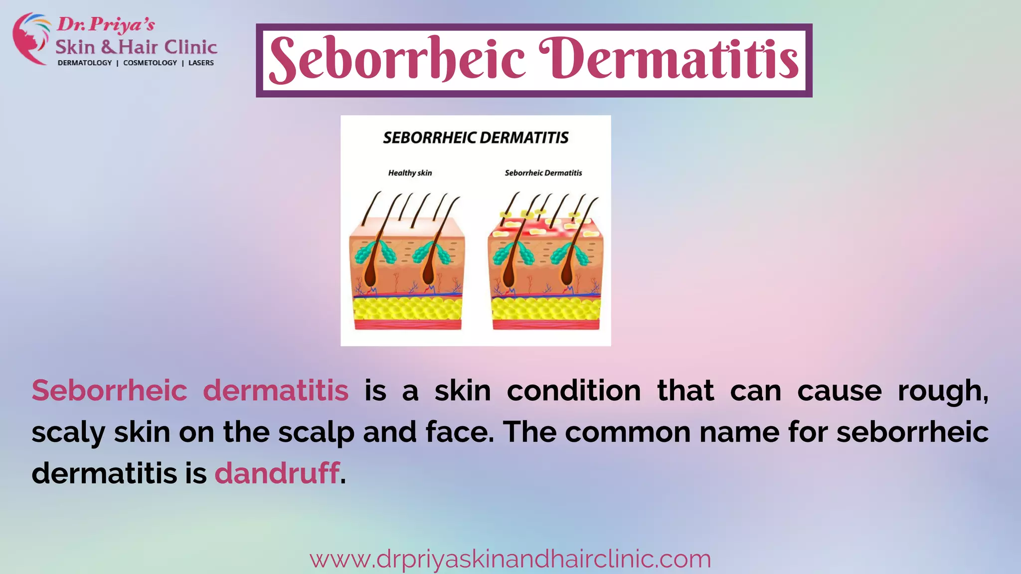 Scalp Psoriasis Vs Seborrheic Dermatitis | PDF
