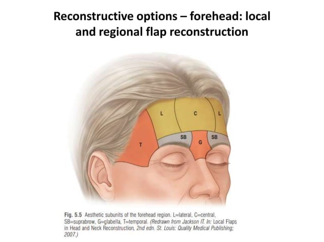 Scalp reconstruction | PPTX