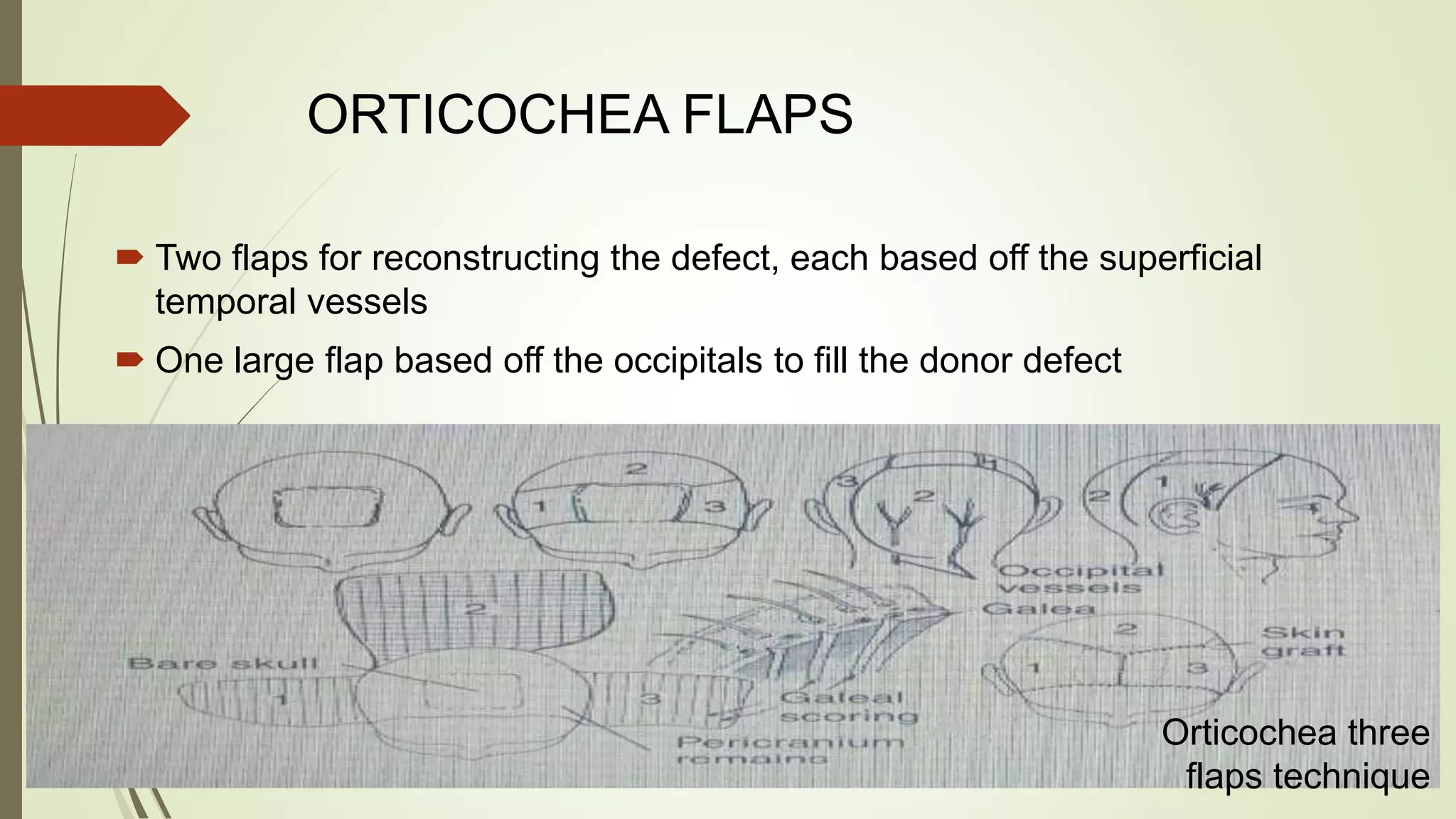 Ortichochea three flap scalp reconstruction by Dr Ali Mujtaba | PPTX