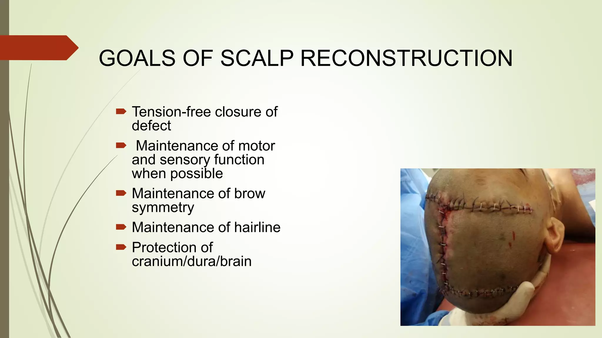 Ortichochea three flap scalp reconstruction by Dr Ali Mujtaba | PPTX