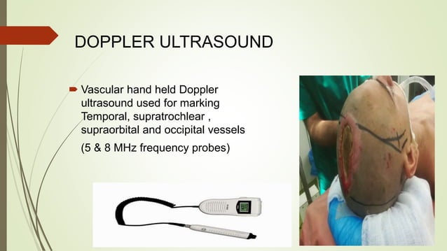 Ortichochea three flap scalp reconstruction by Dr Ali Mujtaba | PPTX