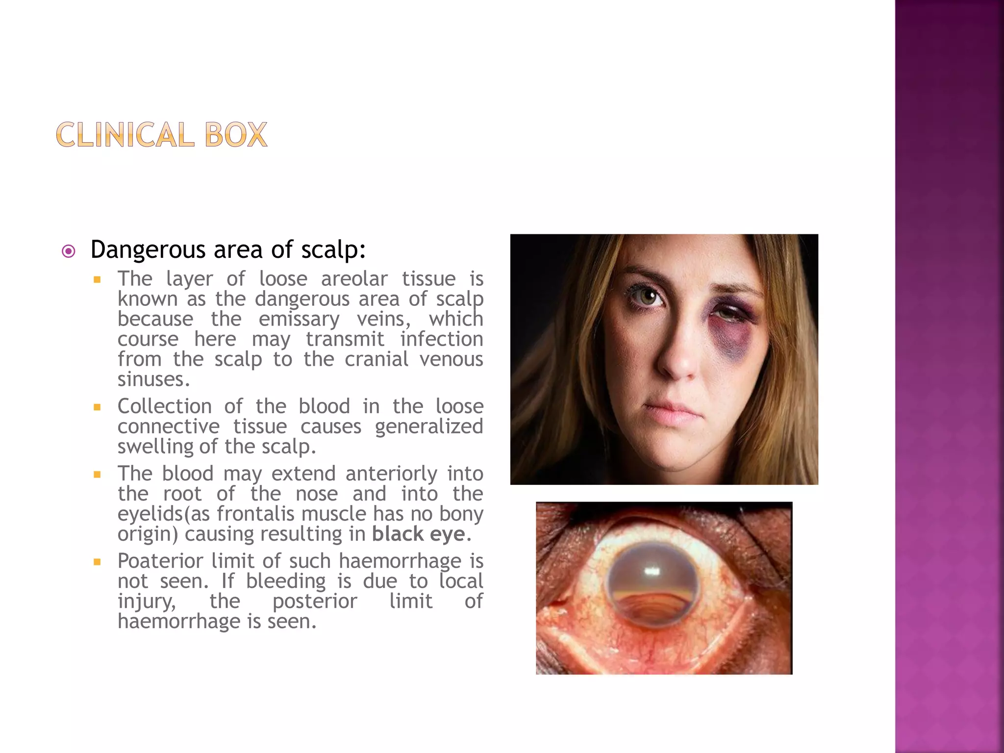Scalp, temple and face | PDF