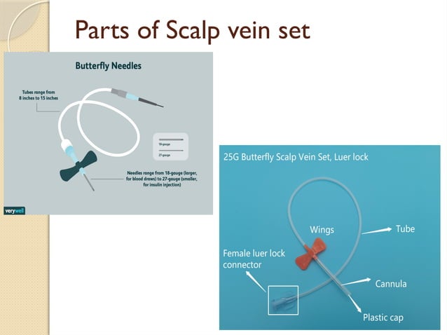 Scalp vein and bulbs collection final.pptx Scalp vein set and blood ...