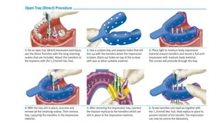 Journal club on scan body department of prosthodontics | PPTX