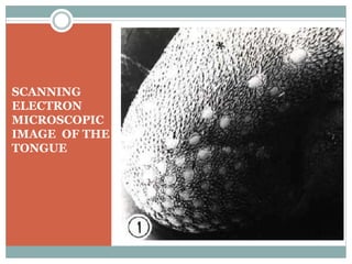 Scanning electon microscope. Dr. GAURAV SALUNKHE | PPTX