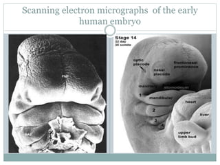 Scanning electon microscope. Dr. GAURAV SALUNKHE | PPTX