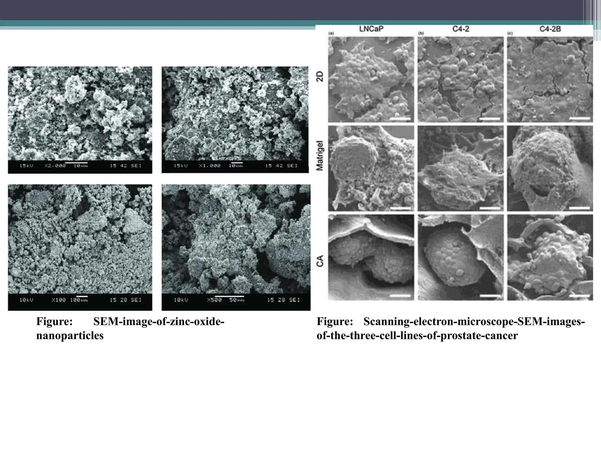 Scanning Electron Microscopy Advantages, Application and Disadvantages ...