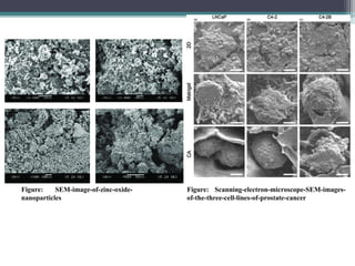 Scanning Electron Microscopy Advantages, Application and Disadvantages ...