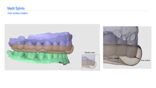 scanning protocols for guided solutions. | PPTX