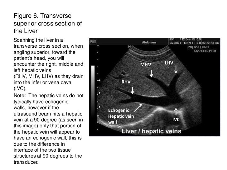 Scanning presentation