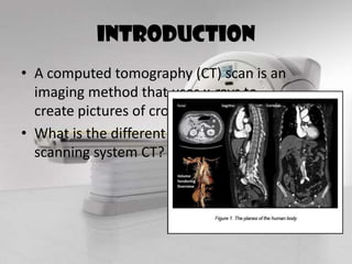Scanning systems, CT Scan | PPTX