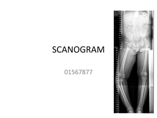 SCANOGRAM.pptx