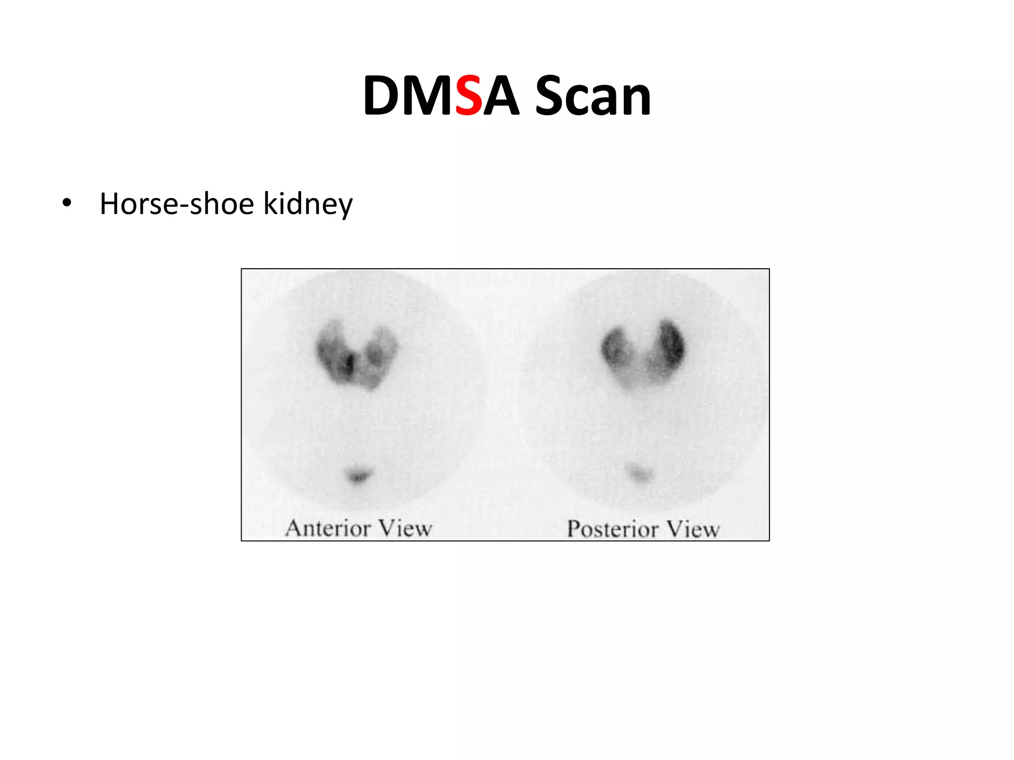Scans.. Dr.Padmesh | PPTX