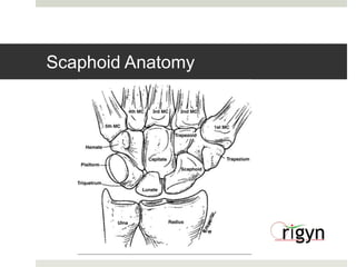 Scaphoid - Tips to fix Scaphoid fractures & Non union management | PPTX