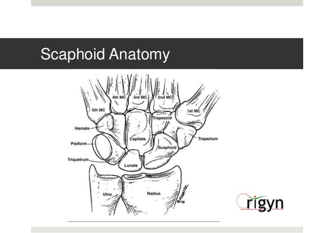 Scaphoid - Tips to fix Scaphoid fractures & Non union management