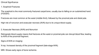scaphoid and talus gffgggggffffffgppt.pptx