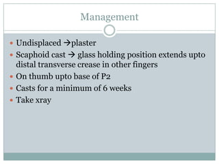 Scaphoid fracture | PPT
