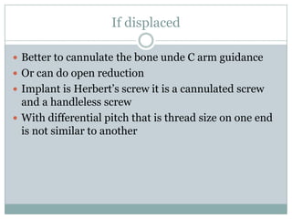Scaphoid fracture | PPT